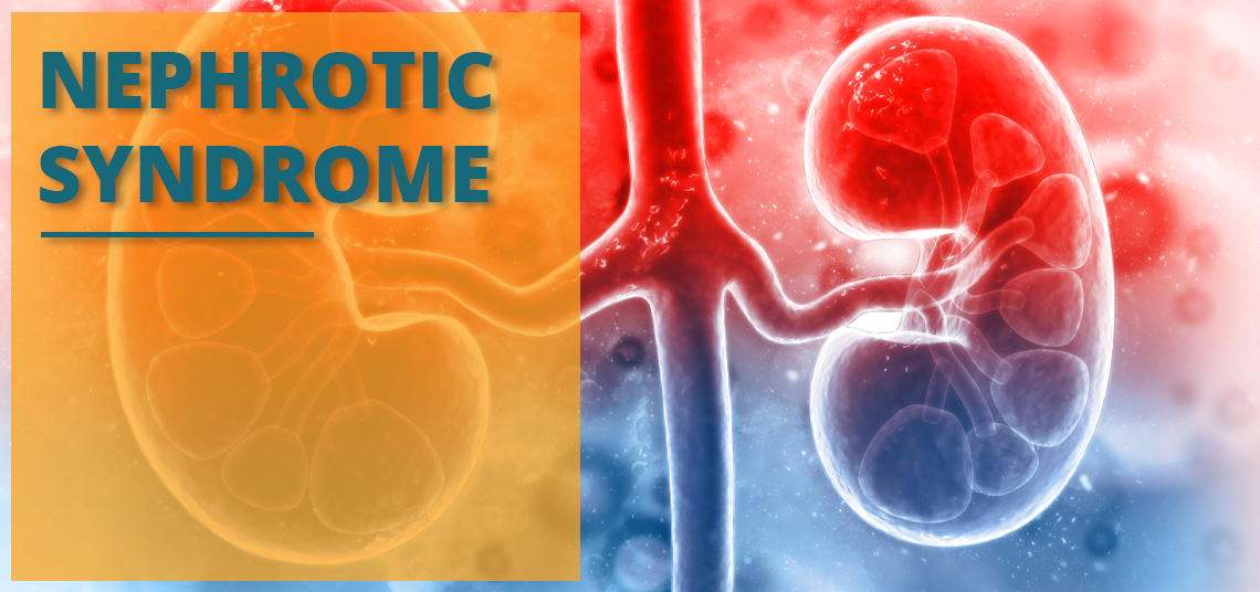 Nephrotic Syndrome Treatment – Dr. Navin Burnwal, Ranchi